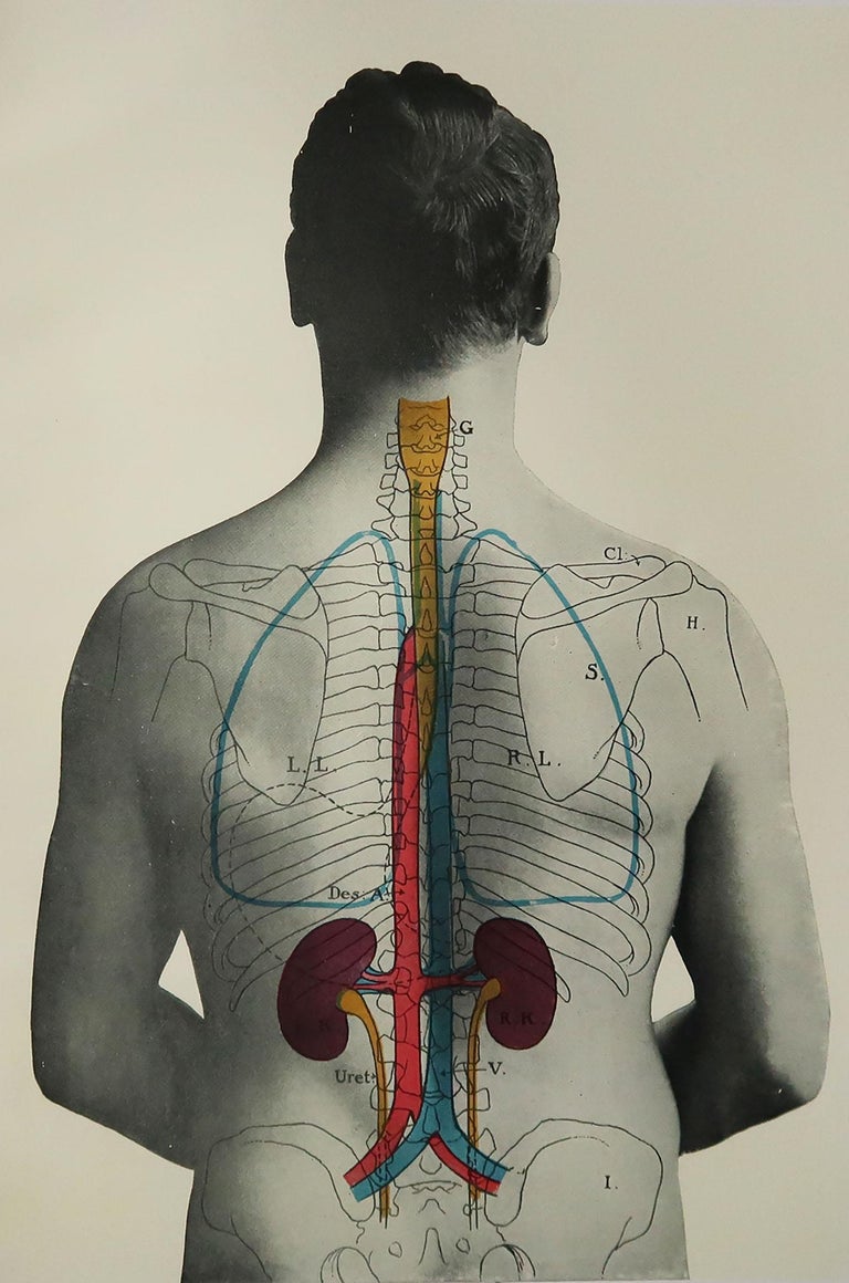 Original Vintage Medical Print- Kidneys, C.1900 For Sale at 1stDibs