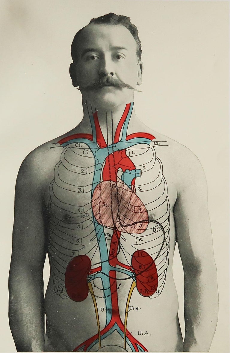 Original Vintage Medical Print- Kidneys, C.1900 at 1stDibs