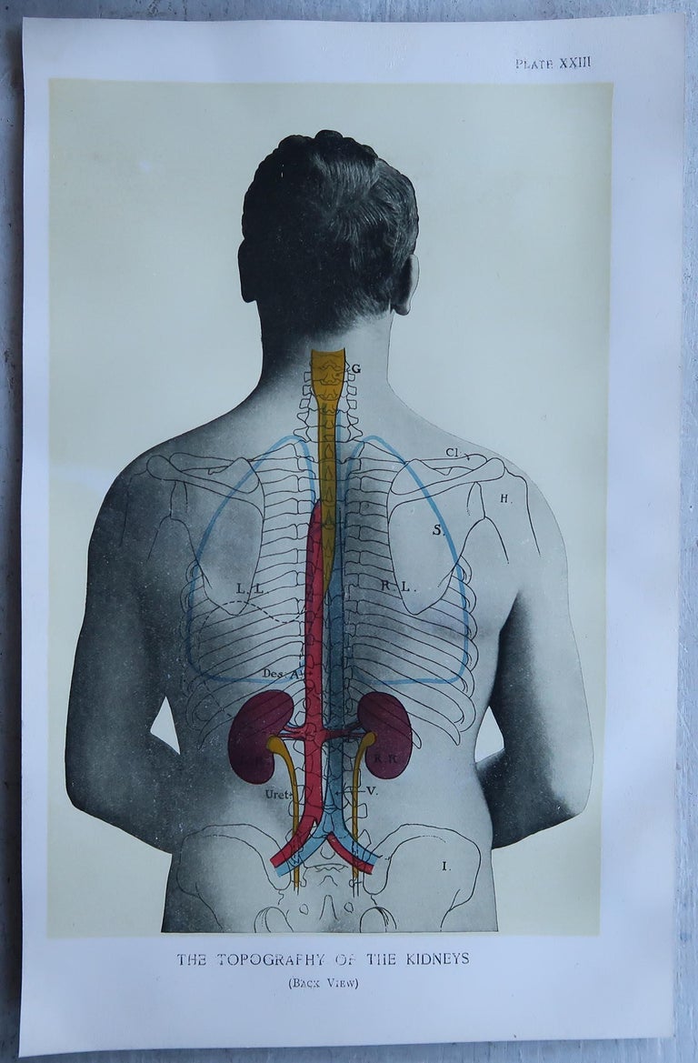 Original Vintage Medical Print- Kidneys, C.1900 For Sale at 1stDibs