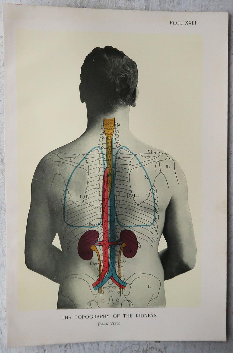 Original Vintage Medical Print- Kidneys, C.1900 For Sale at 1stDibs