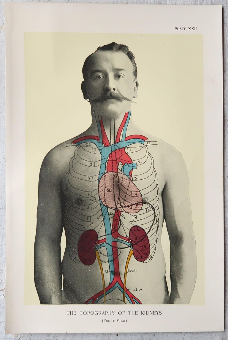 Original Vintage Medical Print- Kidneys, C.1900 at 1stDibs