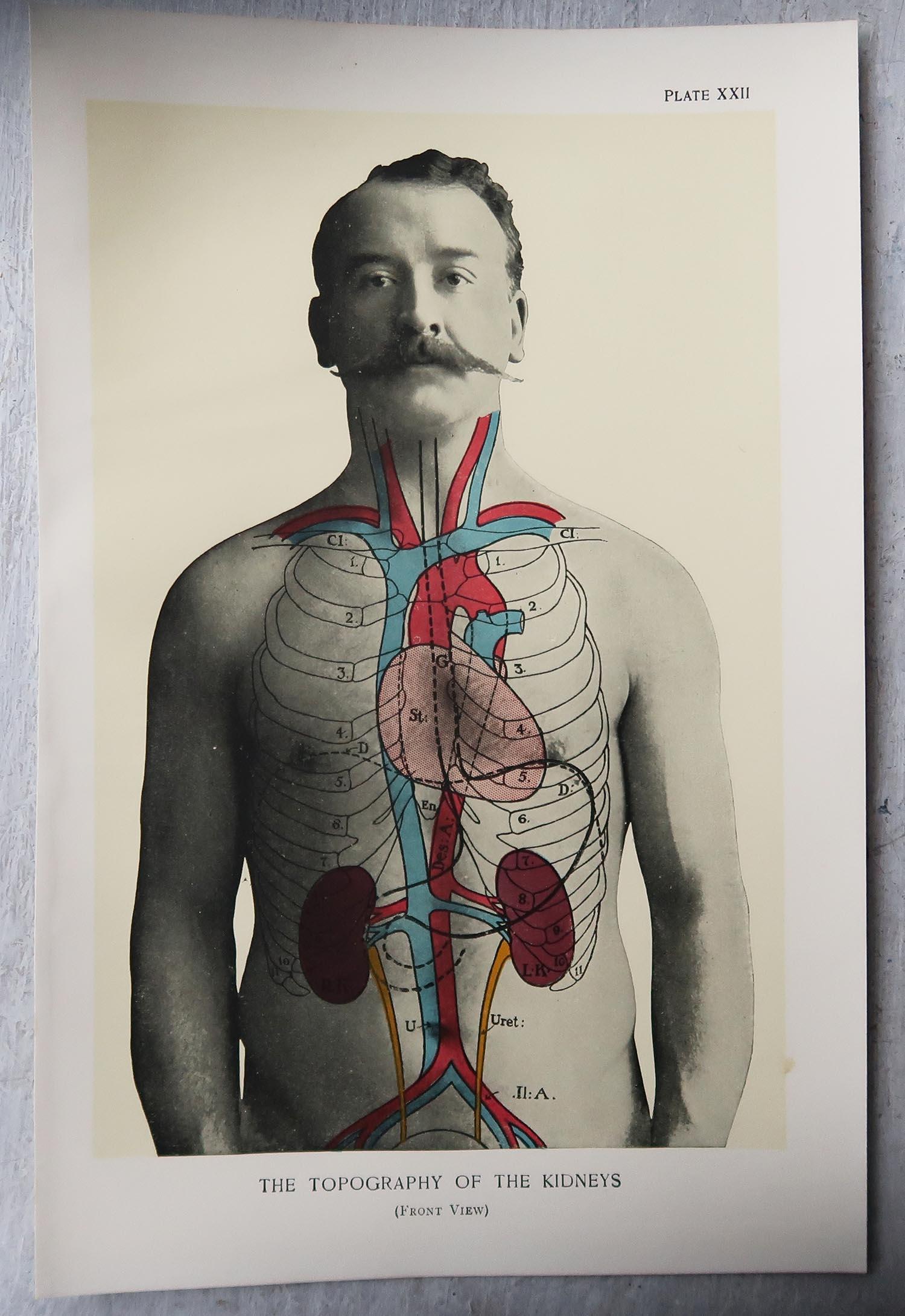 Original Vintage Medical Print, Kidneys, C.1900 For Sale at 1stDibs