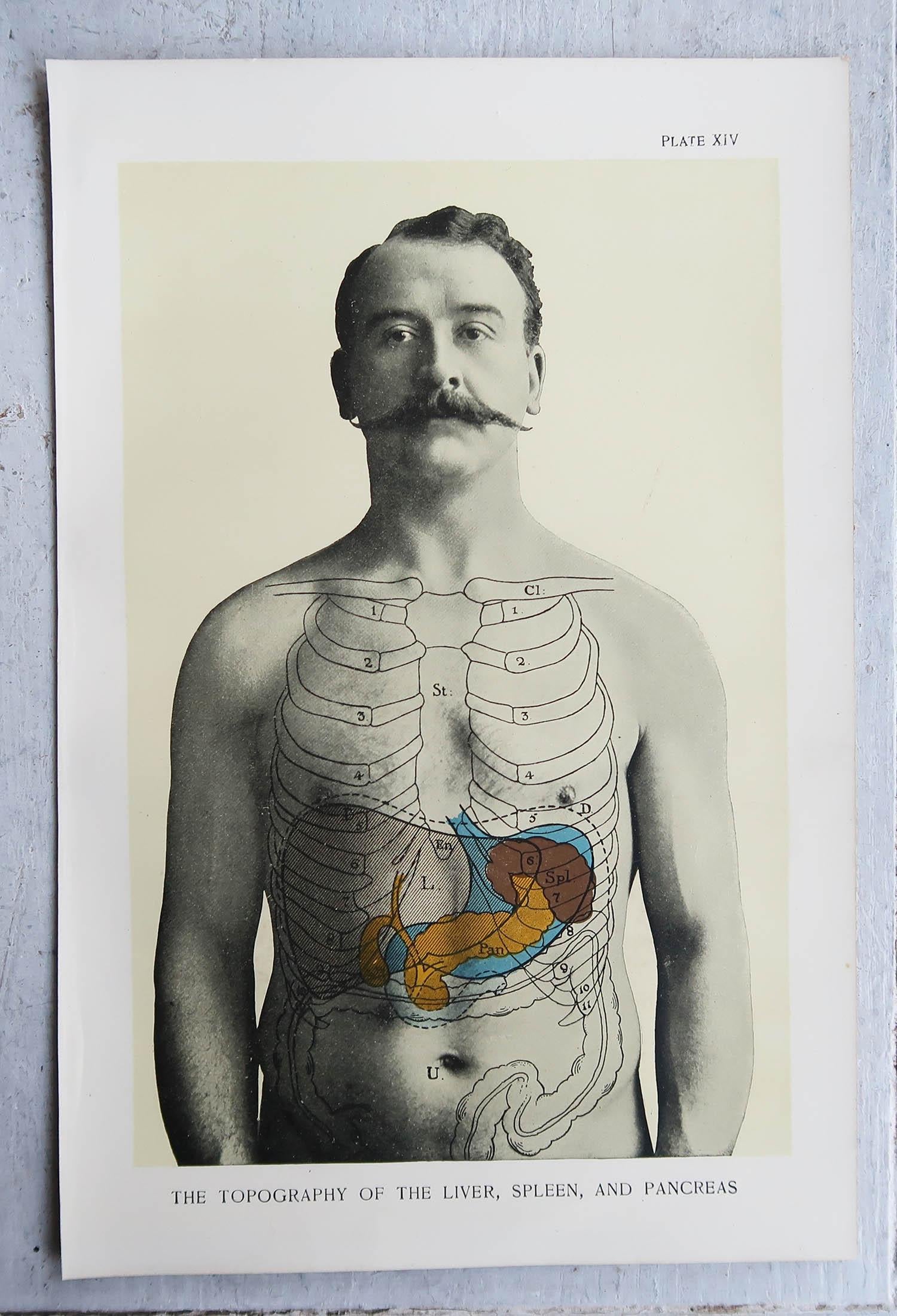 Original Vintage Medical Print, Liver, Spleen and Pancreas, circa 1900 ...