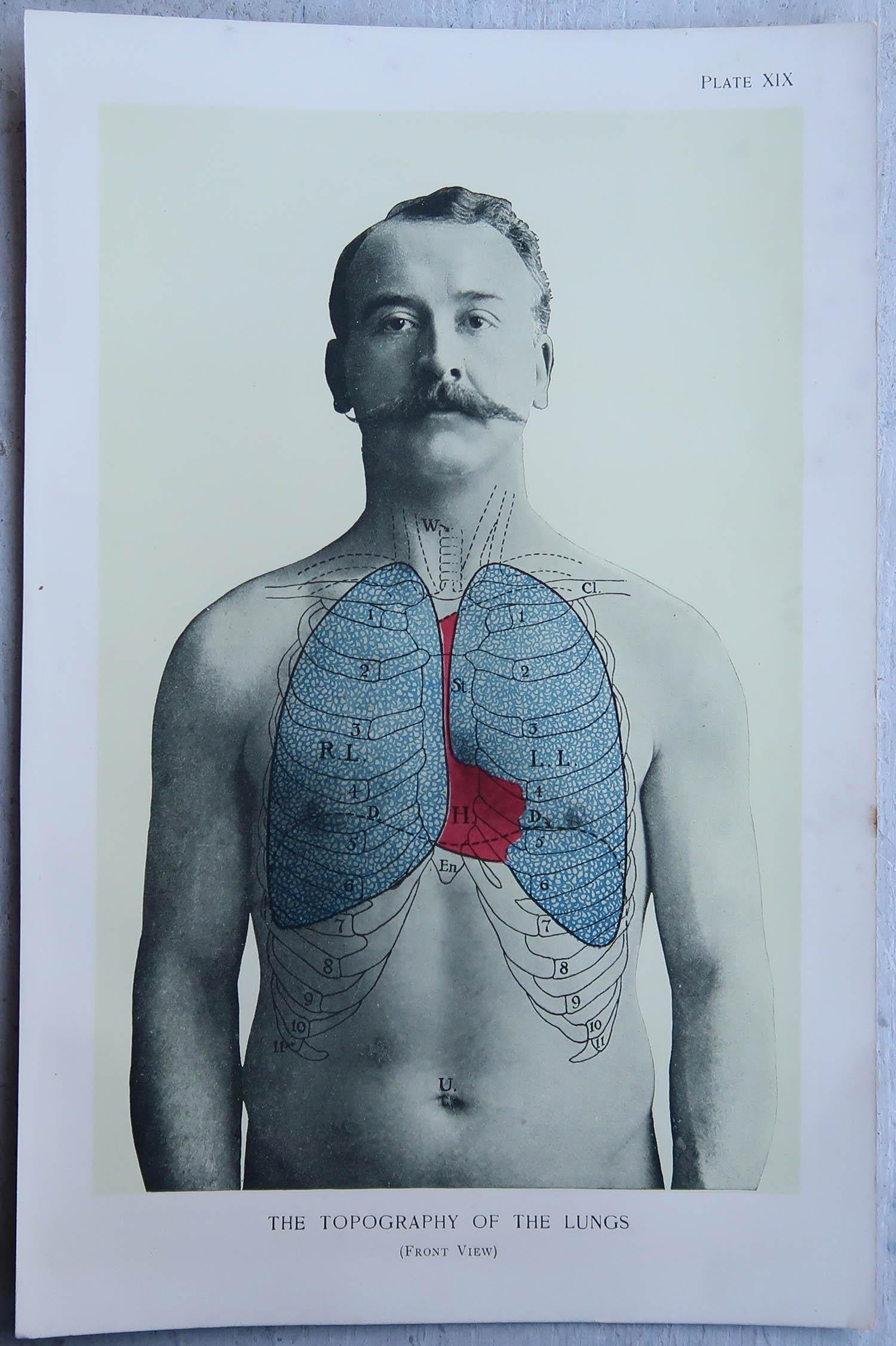 Original Vintage Medical Print, Lungs, C.1900 at 1stDibs