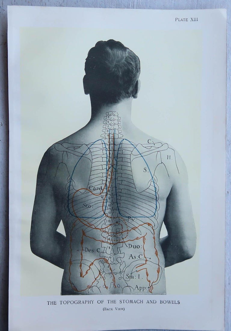 Original Vintage Medical Print, Stomach, C.1900 For Sale at 1stDibs