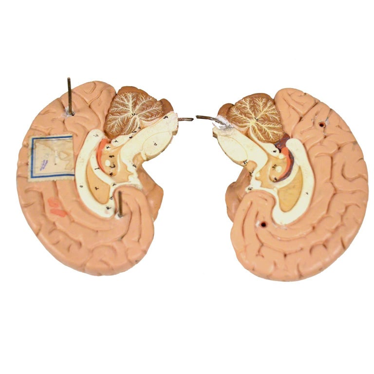 Papier Mache and Plaster Model of Human Brain Made in Prague in the ...