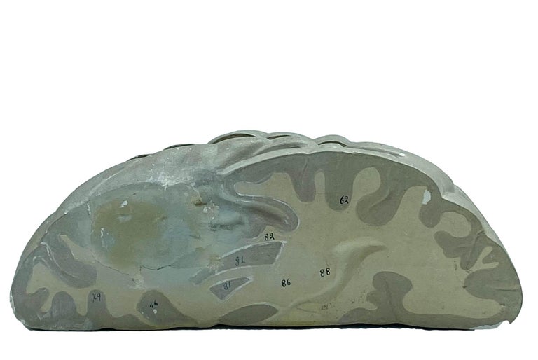 Paravia Educational Anatomical Model of the Base of the Human Skull ...