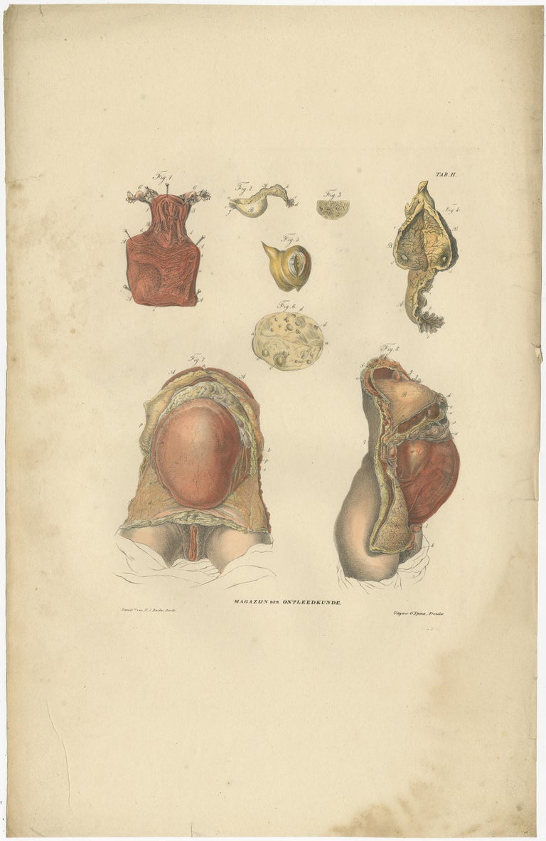 Set of 6 Antique Anatomy Prints of the Female Reproductive System, 1839 ...