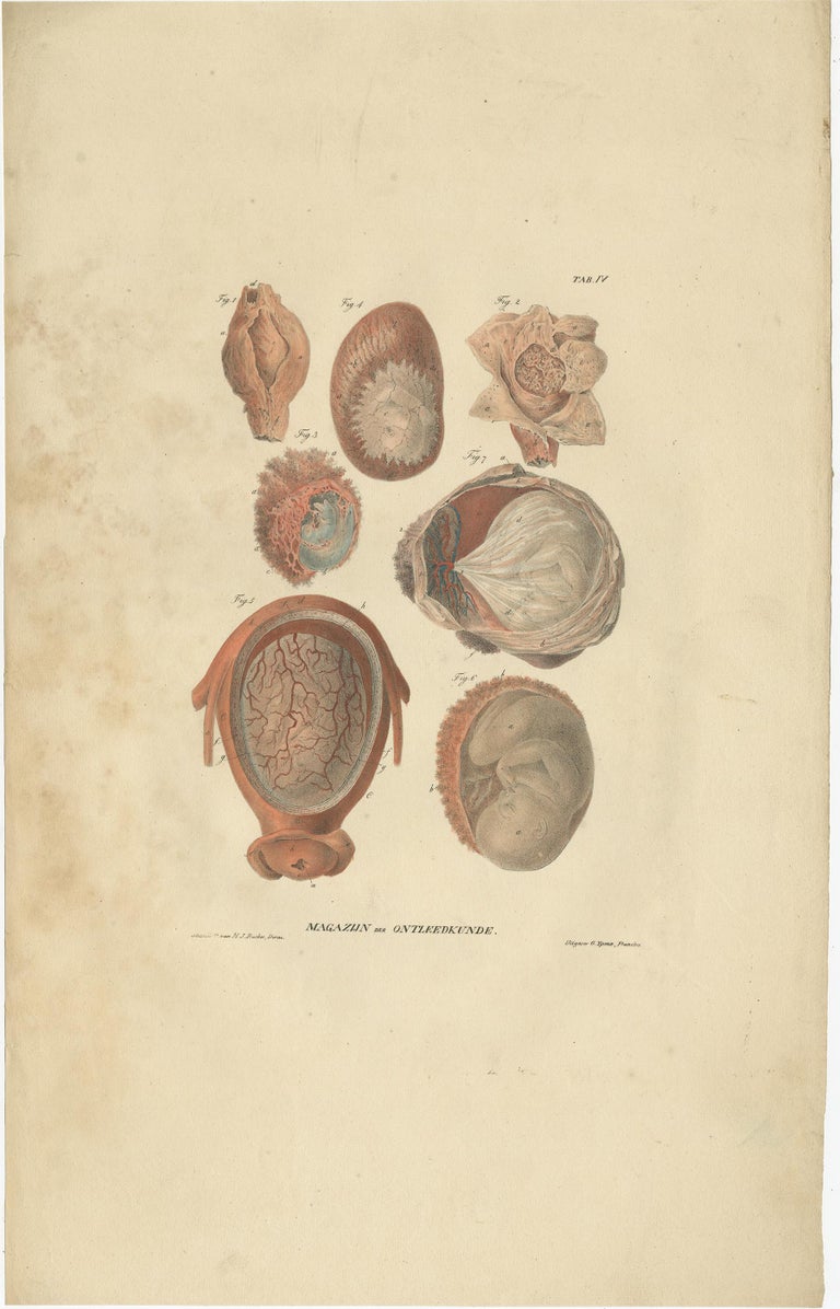 Set of 6 Antique Anatomy Prints of the Female Reproductive System, 1839 ...