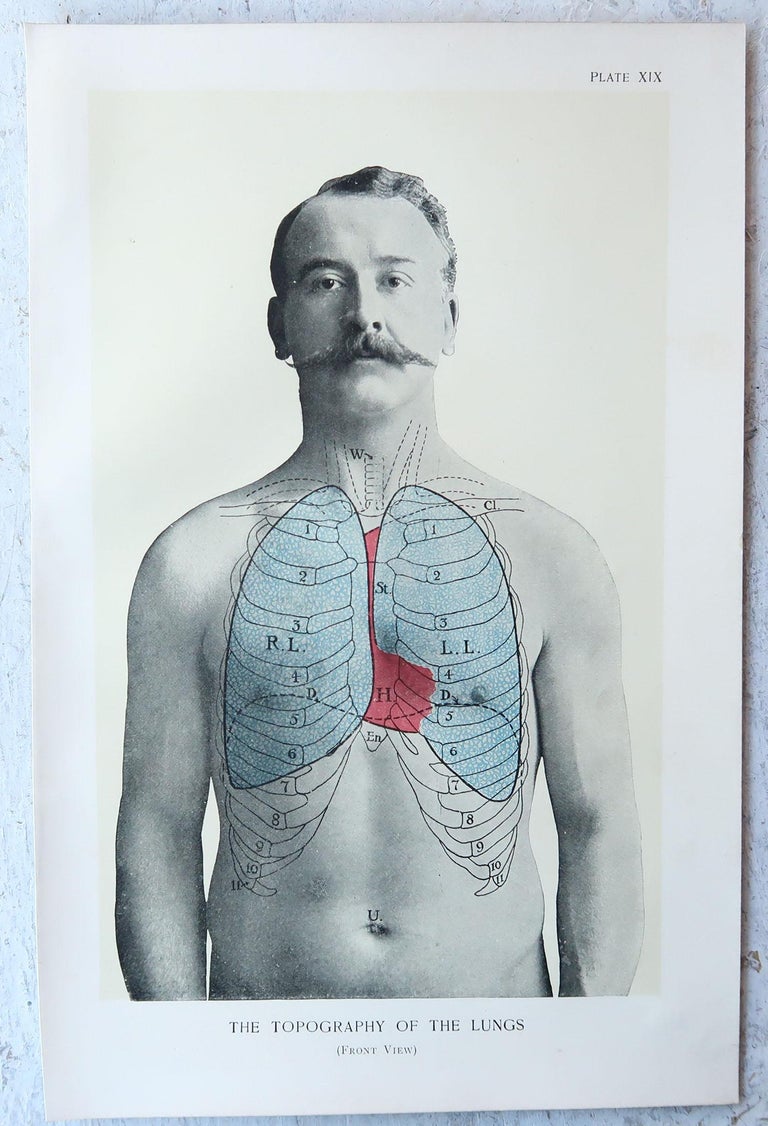 Set of 8 Original Vintage Medical Prints, C.1900 For Sale at 1stDibs