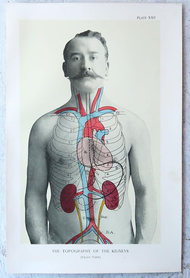 Set of 8 Original Vintage Medical Prints, C.1900 For Sale at 1stDibs