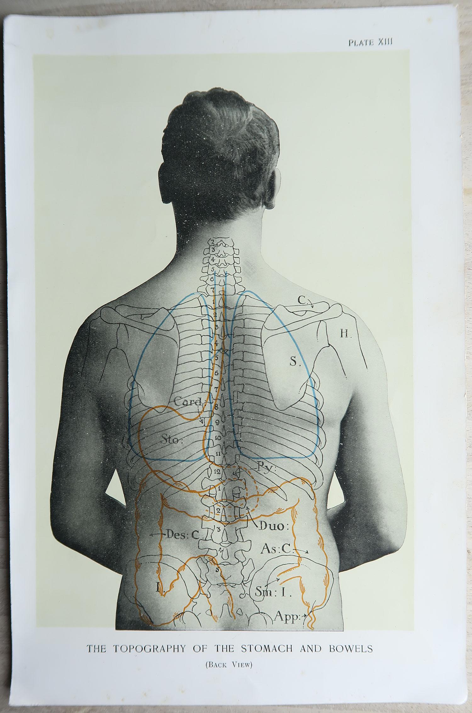 Set of 8 Original Vintage Medical Prints, C.1900 at 1stDibs