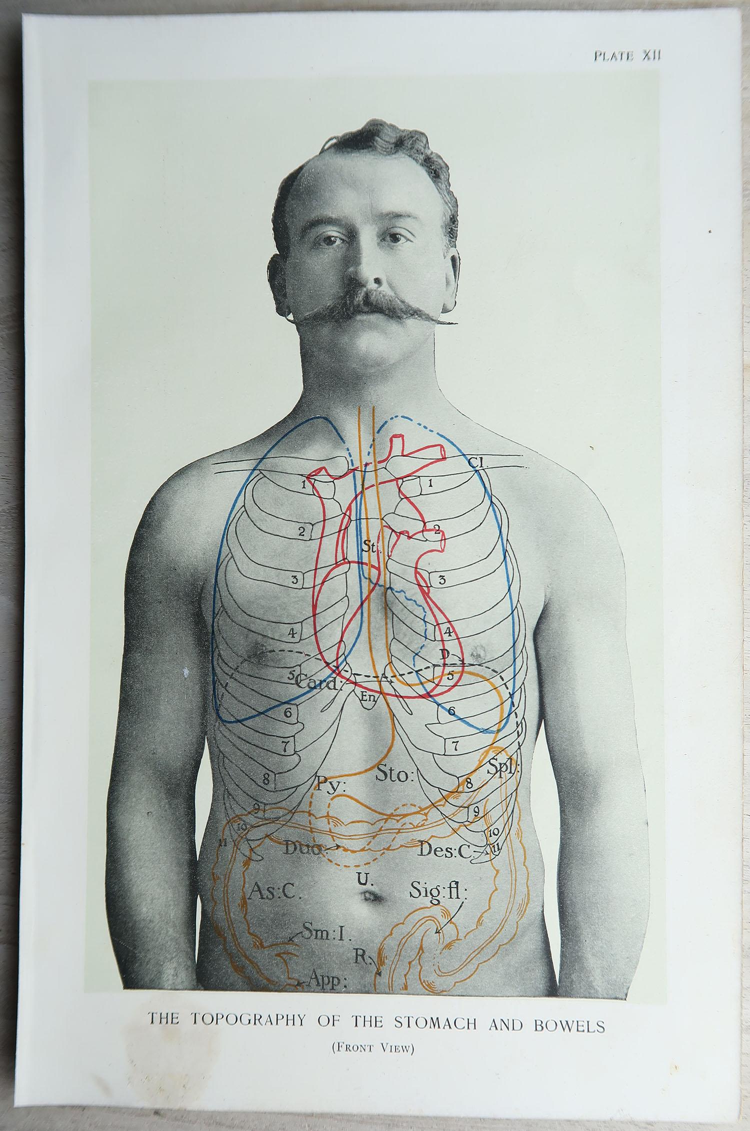 Set of 8 Original Vintage Medical Prints, C.1900 at 1stDibs