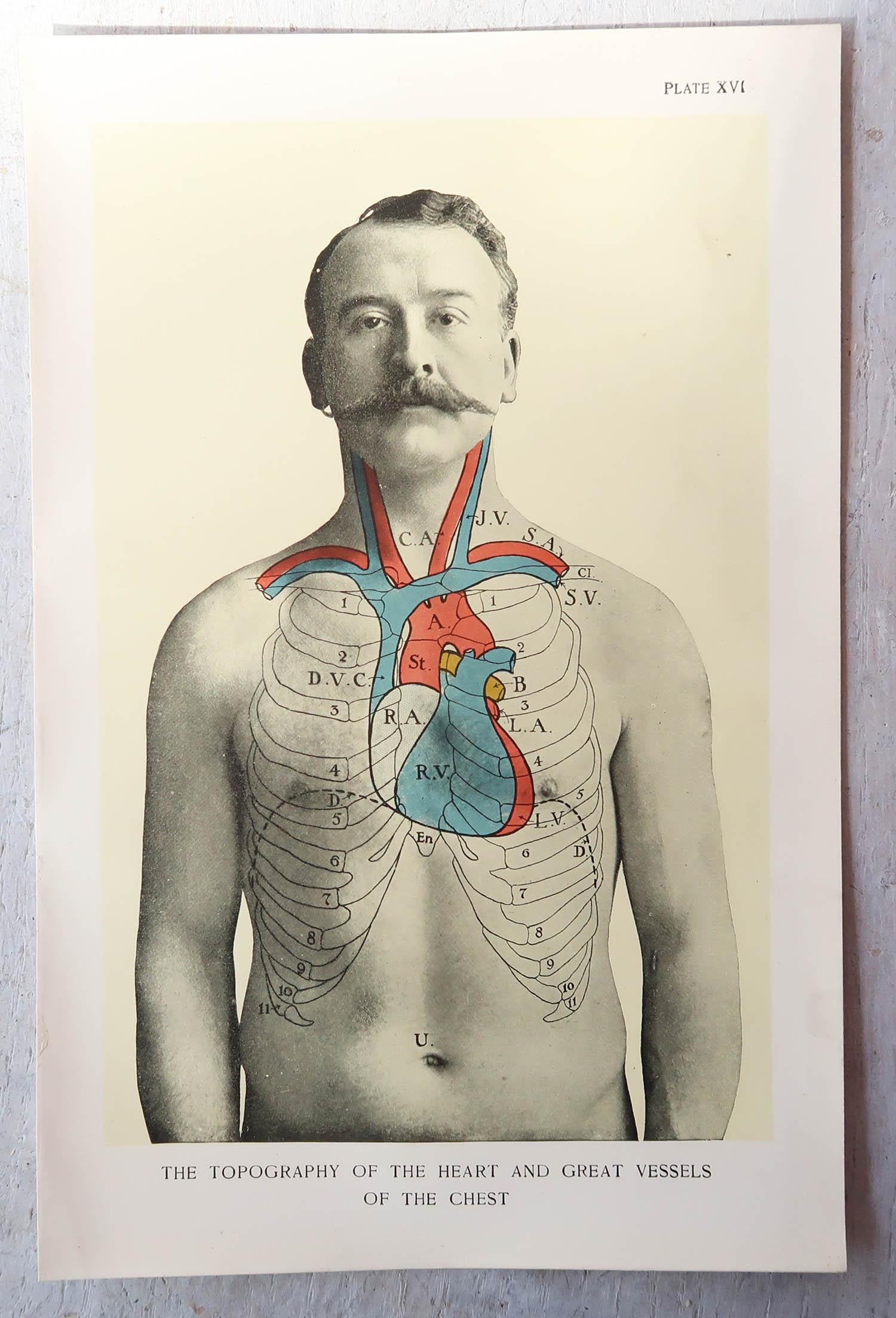 Set of 8 Original Vintage Medical Prints, circa 1900 at 1stDibs