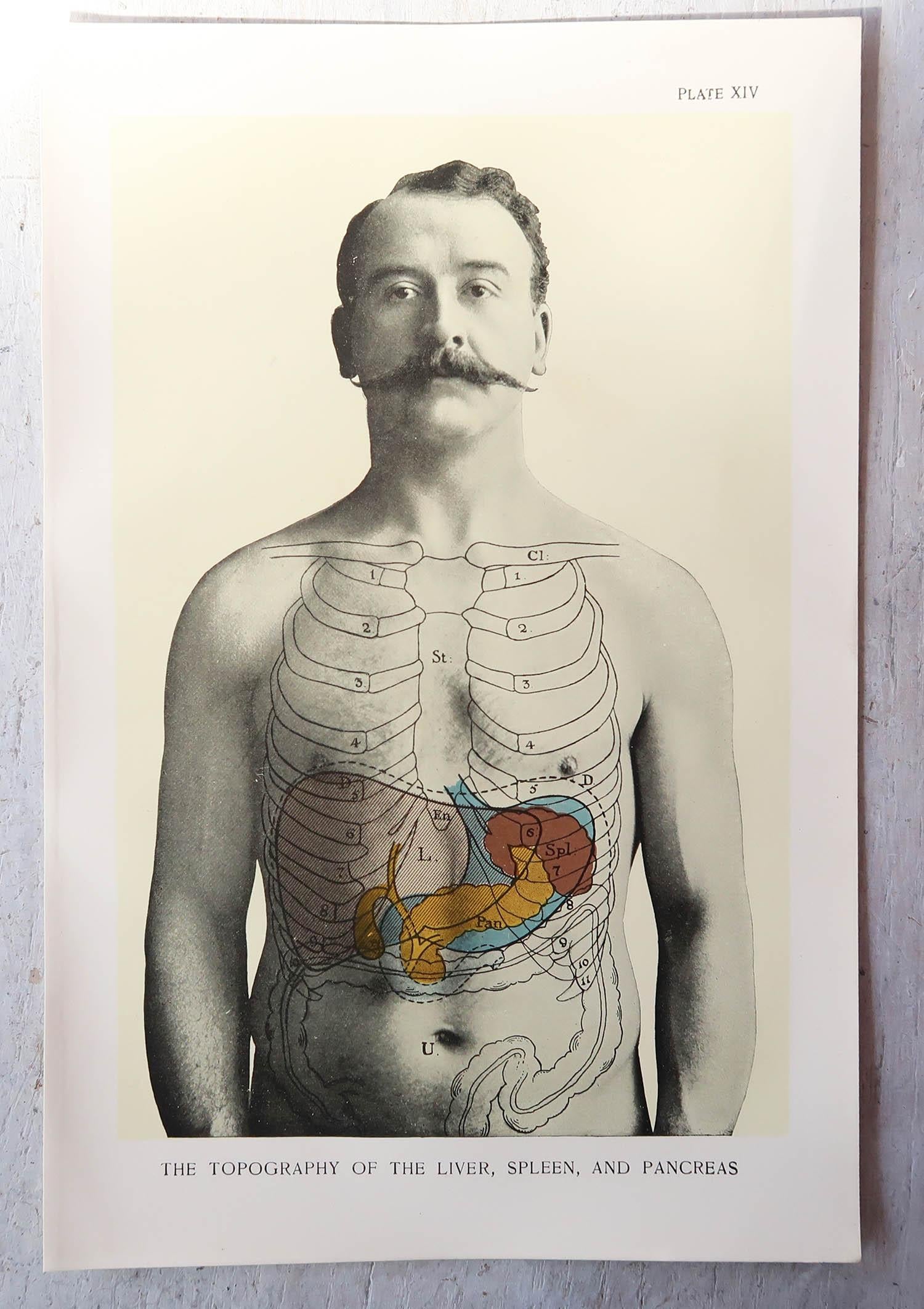 Set of 8 Original Vintage Medical Prints, circa 1900 at 1stDibs