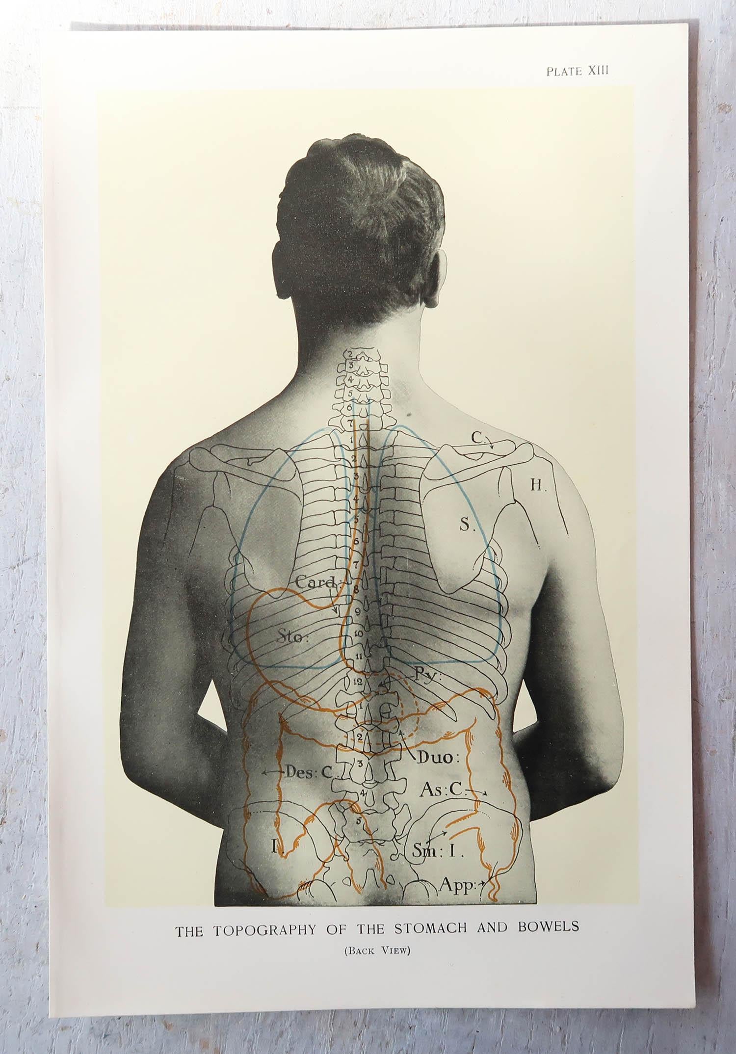 Set of 8 Original Vintage Medical Prints, circa 1900 at 1stDibs
