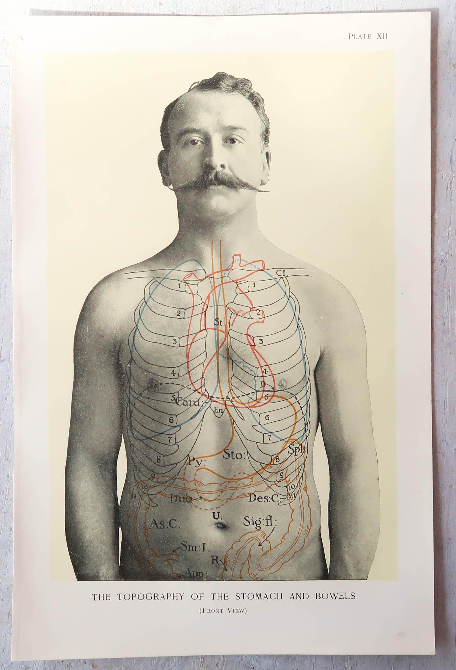 Set of 8 Original Vintage Medical Prints, circa 1900 at 1stDibs