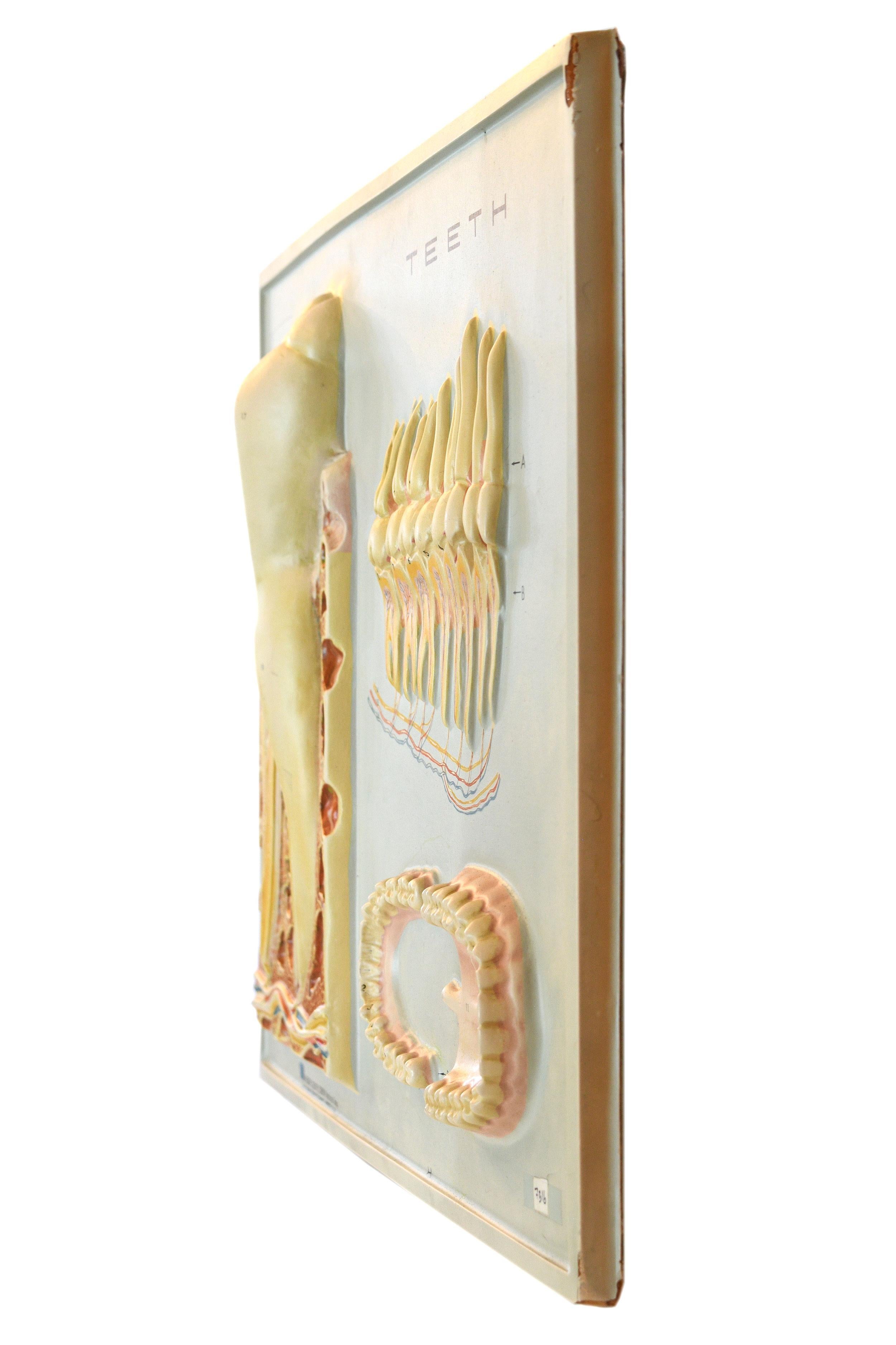 Teeth Cross Section 3D Diagram at 1stDibs | teeth model labeled, tooth ...