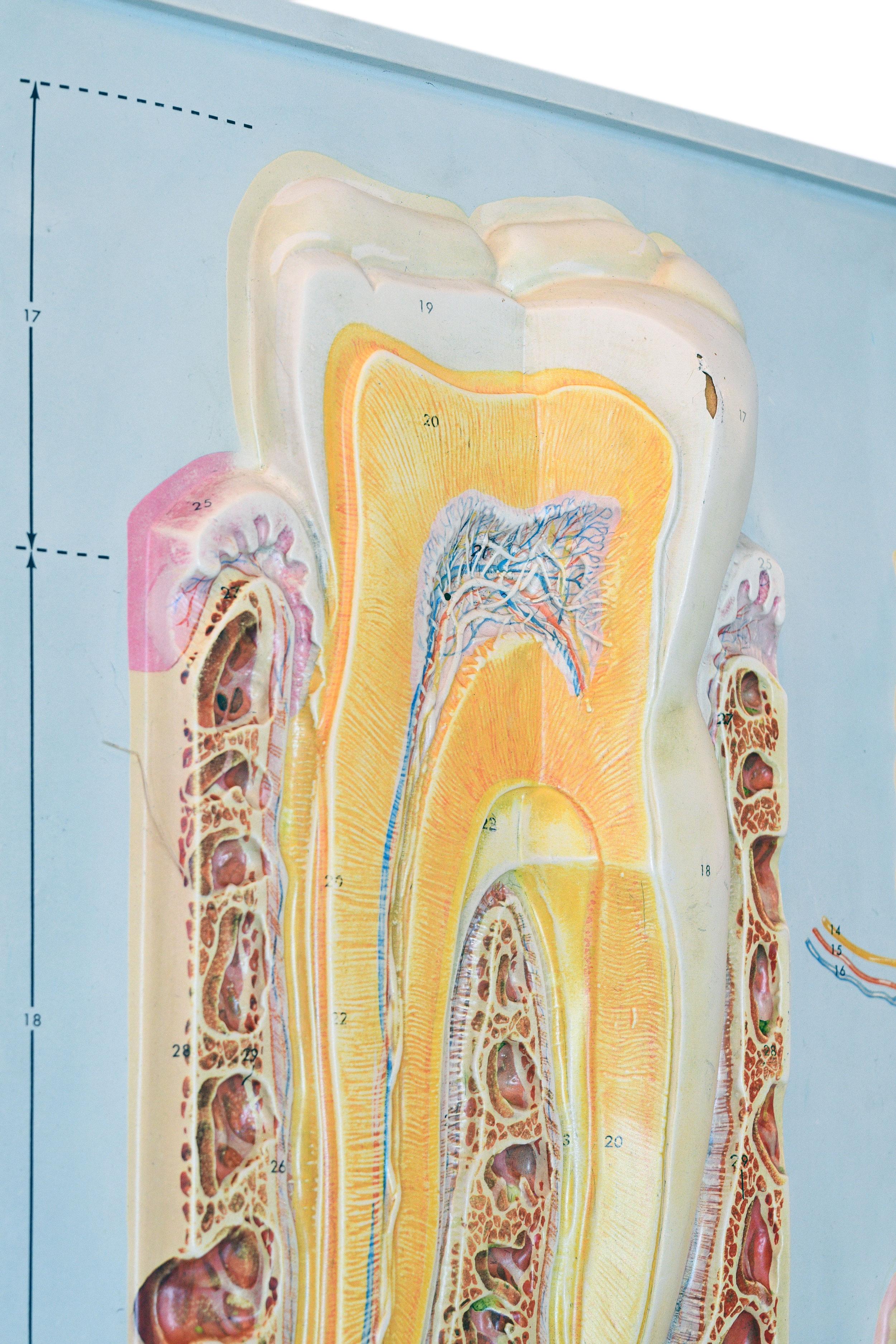 Teeth Cross Section 3D Diagram at 1stDibs | teeth model labeled, tooth ...