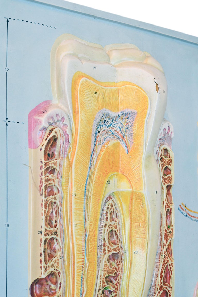Teeth Cross Section 3D Diagram at 1stDibs