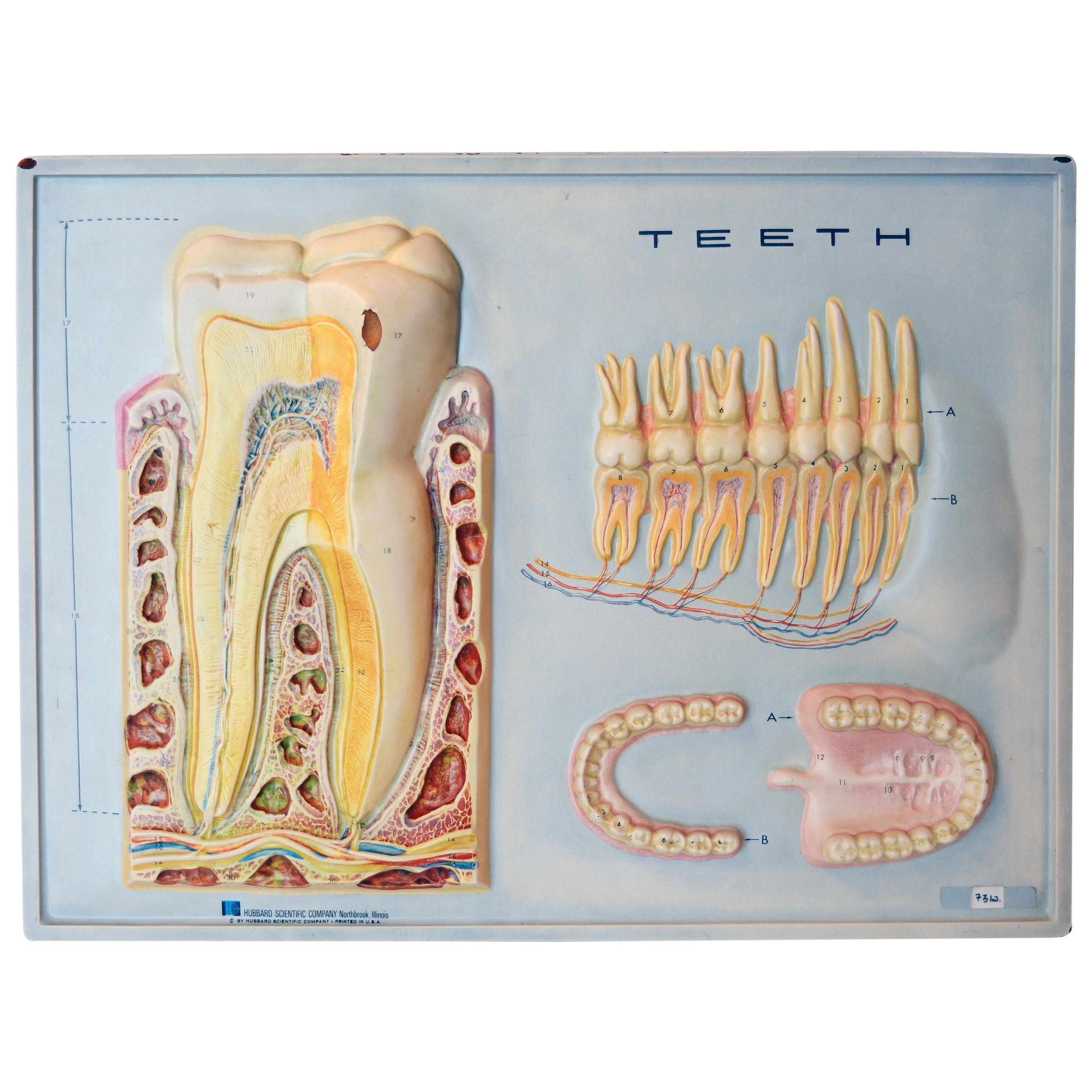 Teeth Cross Section 3D Diagram at 1stDibs | teeth model labeled, tooth ...