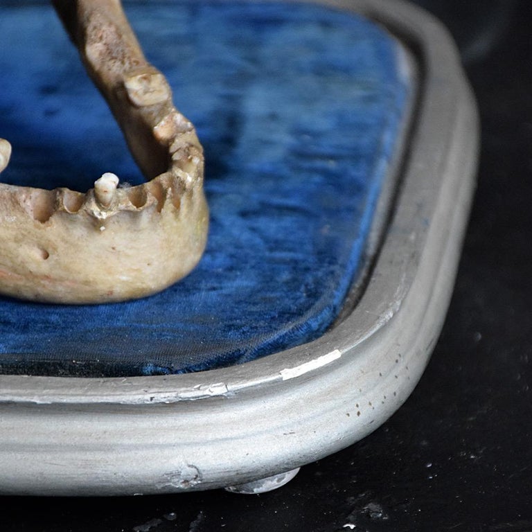 Victorian Medical Human Skull in Glass Dome at 1stDibs | human skull ...