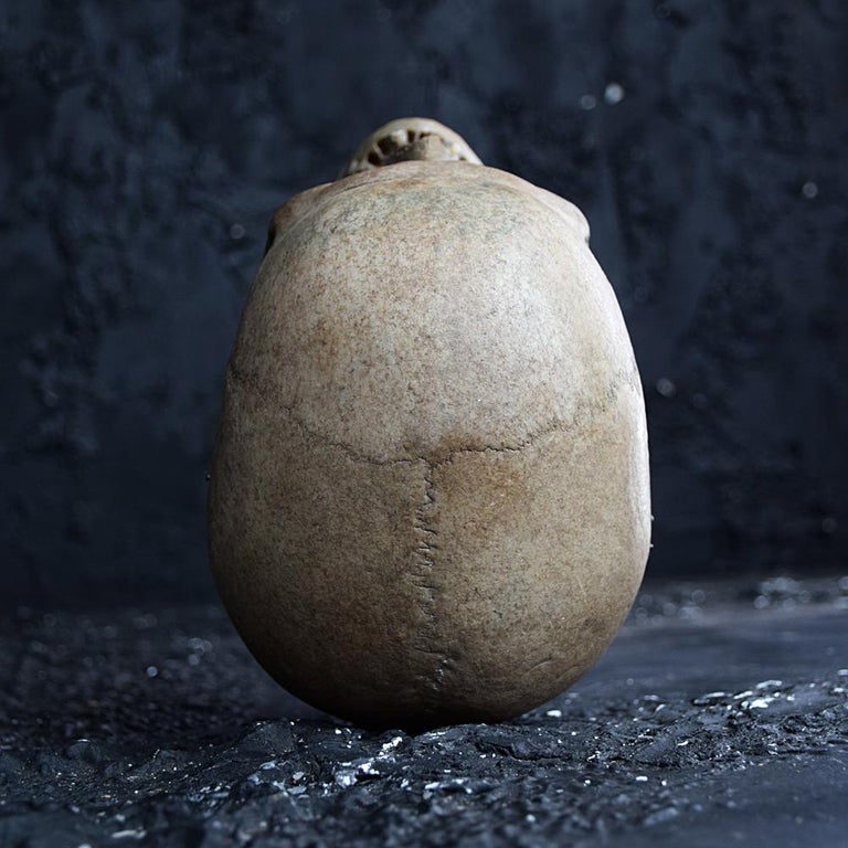 Victorian Medical Human Skull in Glass Dome at 1stDibs | human skull ...